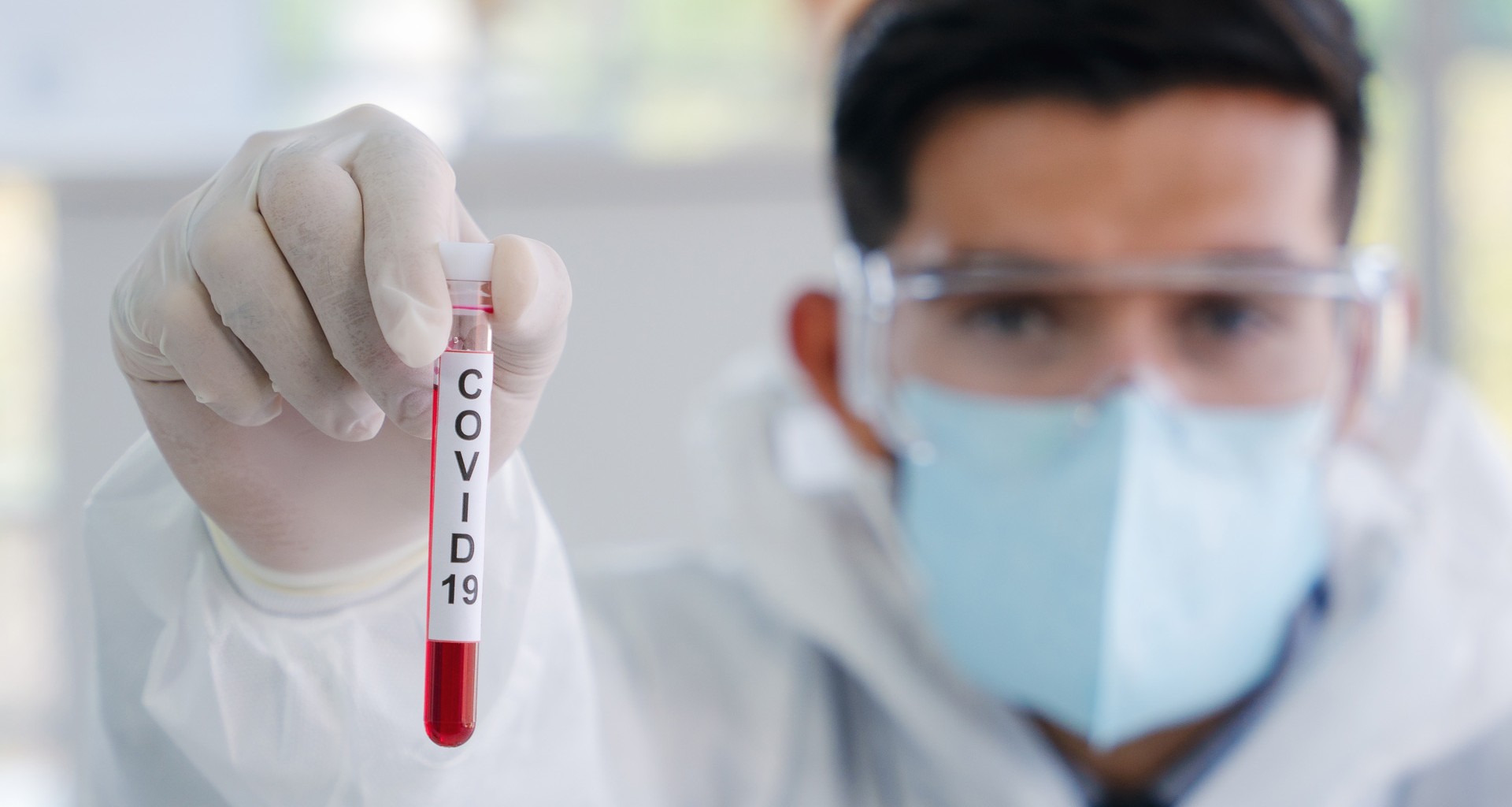 Mungesa e kësaj vitamine mund të ju vë në rrezik nga Covid-19, thotë ...
