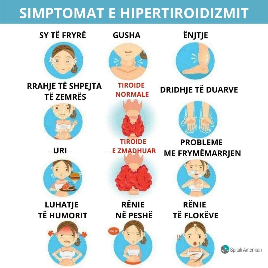 Simptomat e hipertiroidizmit - Gazeta Express