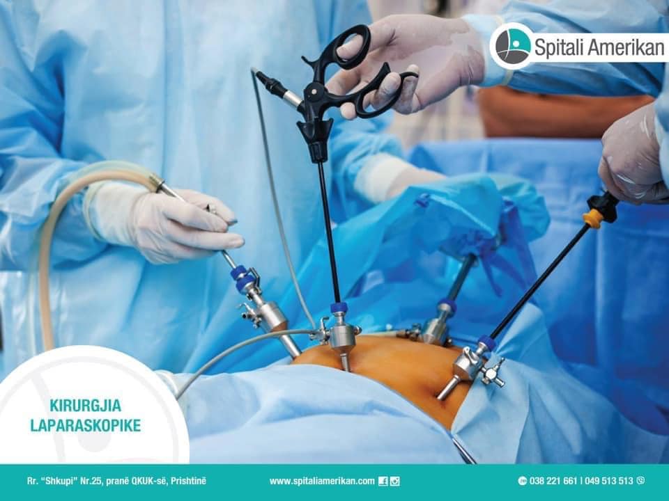 ÇFARË ËSHTË KIRURGJIA LAPARASKOPIKE - Gazeta Express