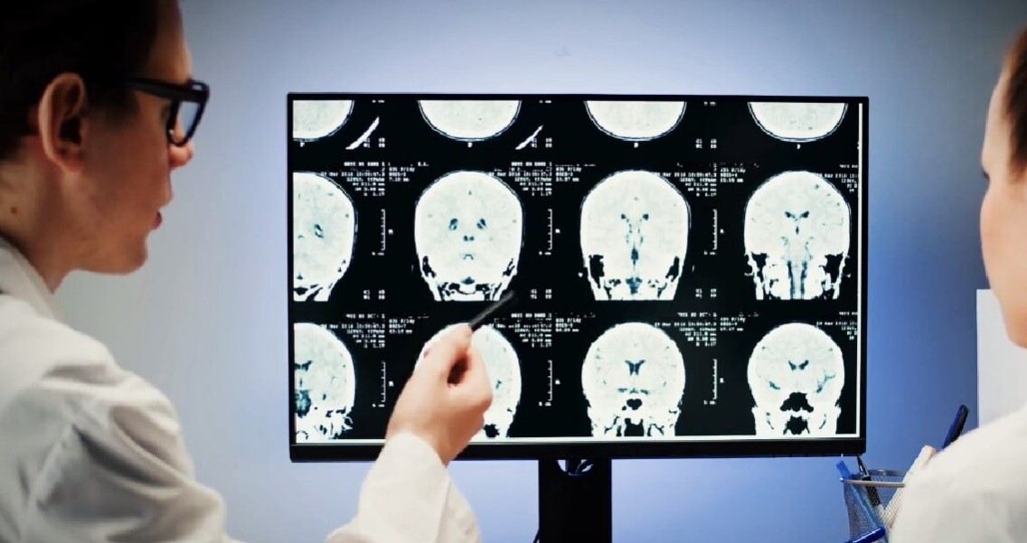 Ilaçi për kancerin e gjirit ul rrezikun e rikthimit me 25% - Gazeta Express