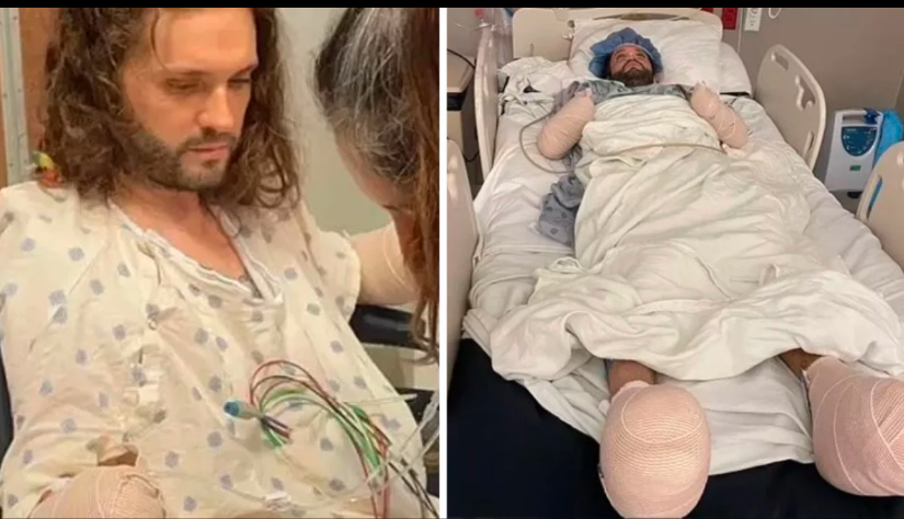 SHBA, 25-vjeçari veteriner humb këmbët dhe duart se e pickuan rriqnat ...