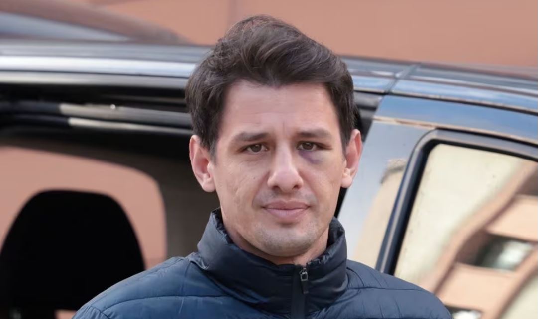 Referi turk që u sulmua fizikisht lirohet nga spitali - Gazeta Express Referi turk që u sulmua fizikisht lirohet nga spitali - Gazeta Express