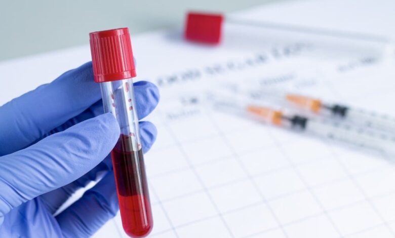 Kanceri i zorrës së trashë mund të zbulohet vetëm me një test gjaku ...