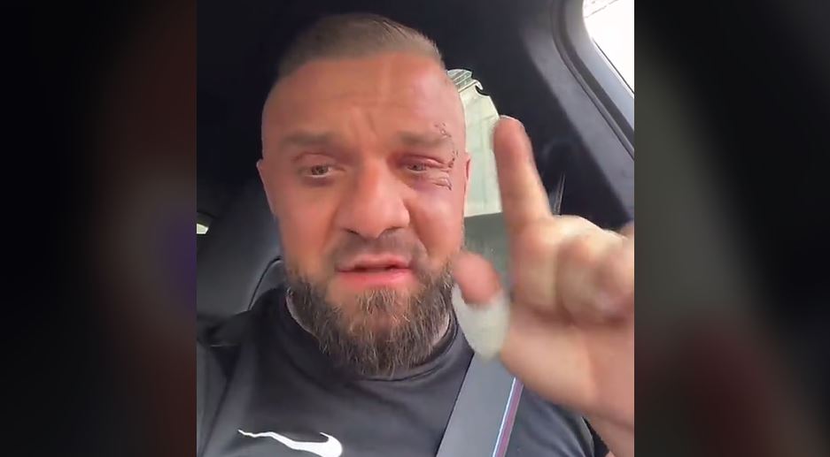 I nxirë dhe me plagë në fytyrë, Medi Iseni publikon video për herë të ...