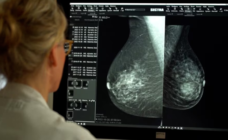 Inteligjenca artificiale mund t’i identifikojë gratë që rrezikohen nga ...