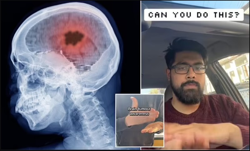 Mjeku demonstron testin 30-sekondësh me duar që mund të zbulojë nëse ...