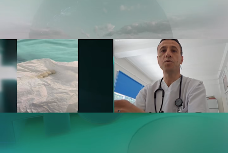 Mjeku nga Peja flet për rastin e rrallë: Proteza e dhëmbëve në lukthin ...